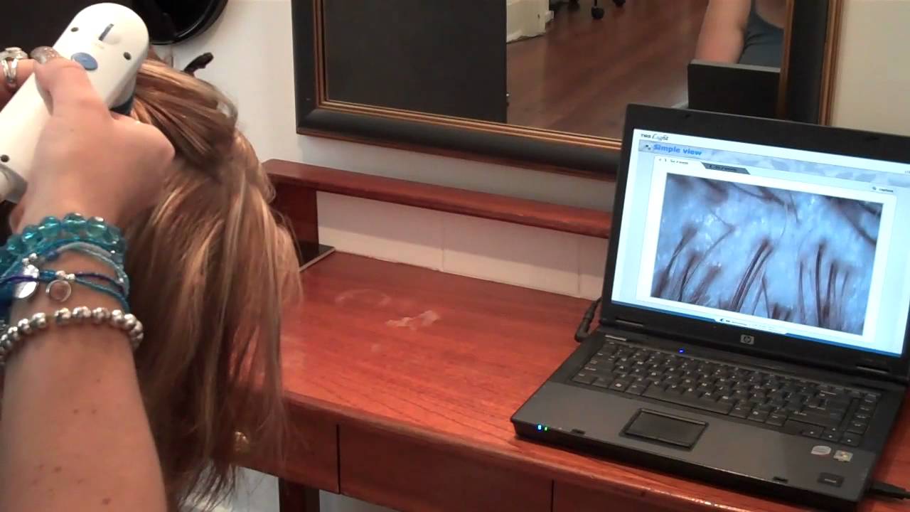 Nano Hair Analysis - Nano Hair Transplant